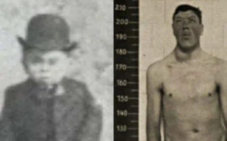 El curioso caso de Adam Rainer, el único hombre en sufrir enanismo y ...